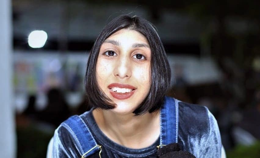 Superação!! Conheça a brasileira que se tornou a primeira modelo do ...